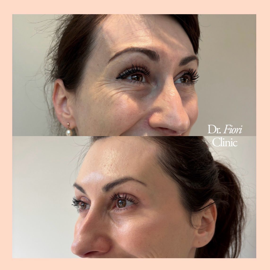 Dr. Fiori Clinic | Luxury Aesthetic Clinic | Chiswick
