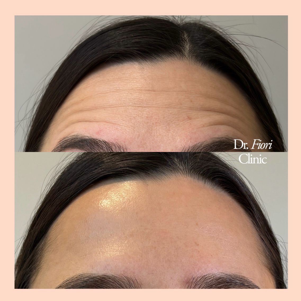 Dr. Fiori Clinic | Luxury Aesthetic Clinic | Chiswick